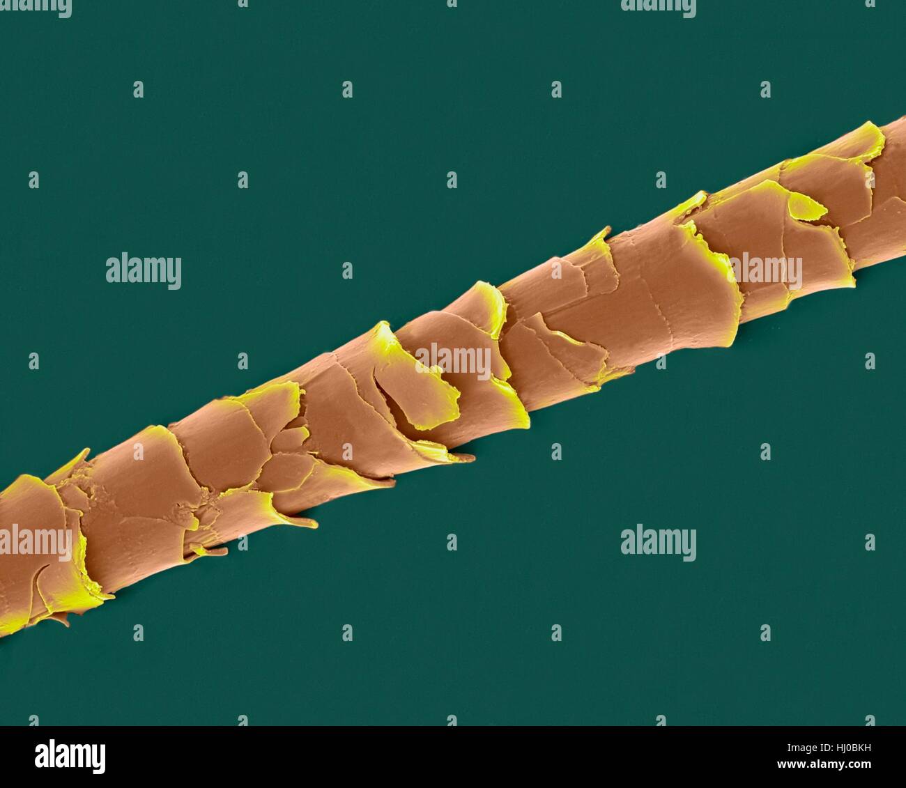 Cuticola dei capelli esterni immagini e fotografie stock ad alta ...