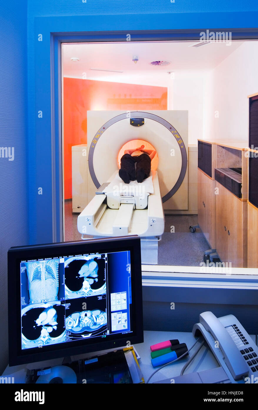 Tomografia torace immagini e fotografie stock ad alta risoluzione - Alamy