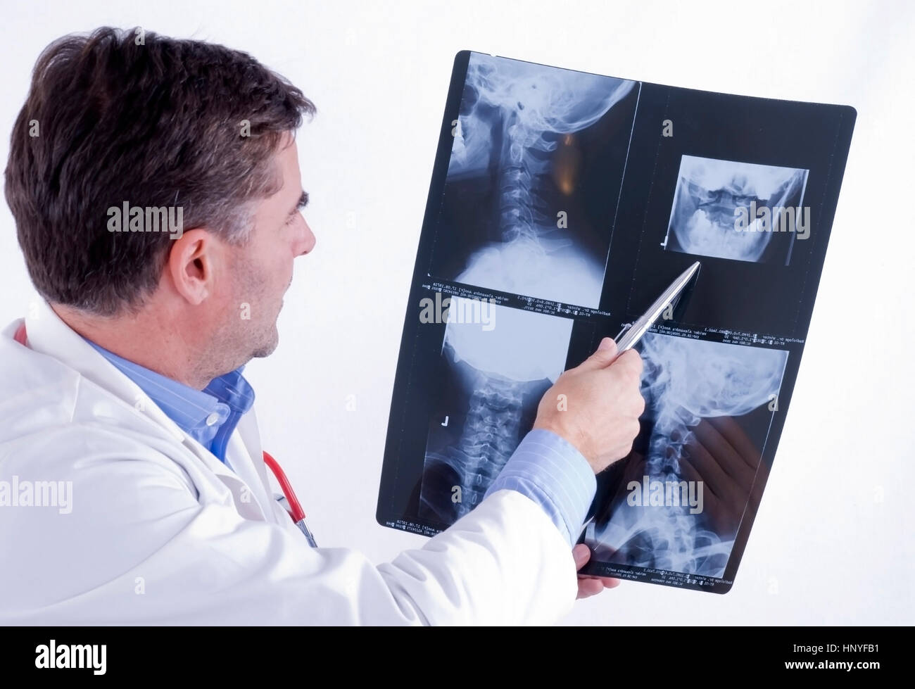 Cervical vertebras immagini e fotografie stock ad alta risoluzione - Alamy