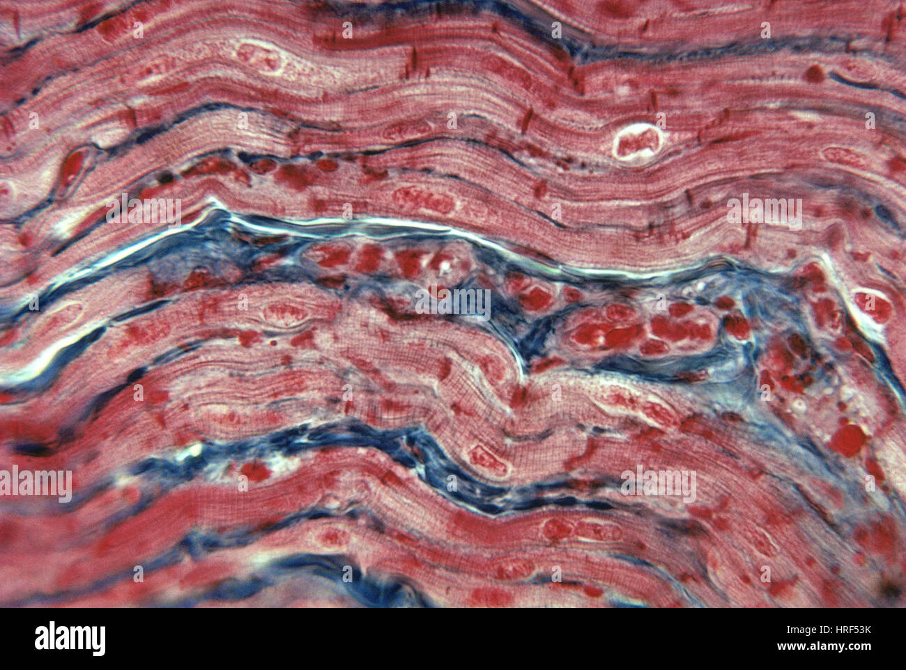 Micrografia del muscolo cardiaco immagini e fotografie stock ad alta ...