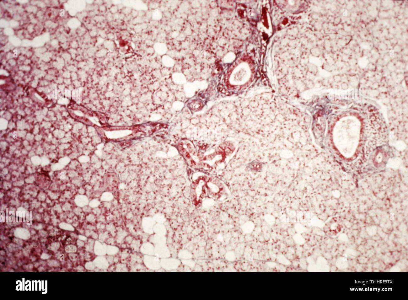 Ghiandola salivare parotide immagini e fotografie stock ad alta ...