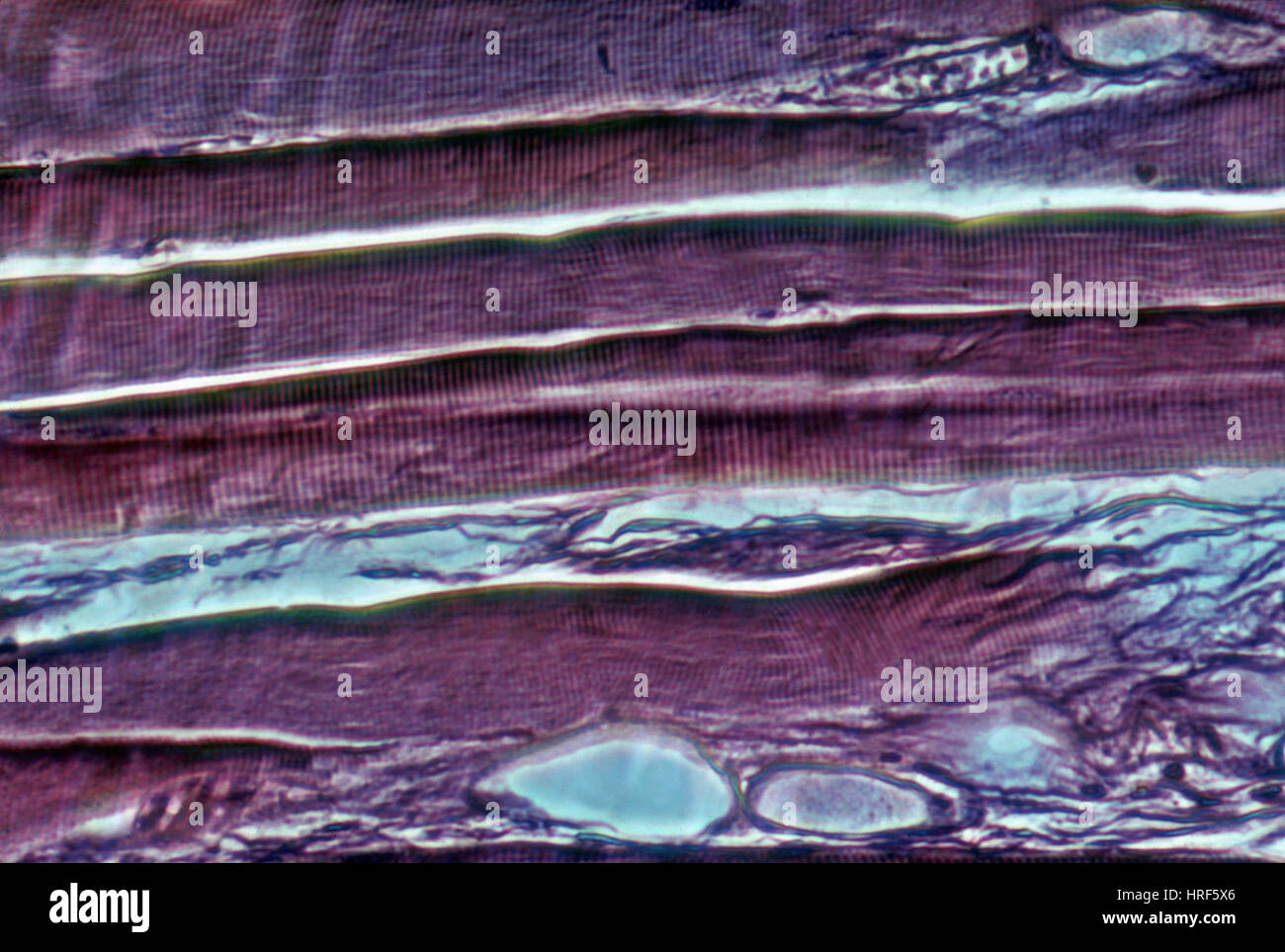 Muscolo Striato Immagini e Fotos Stock - Alamy