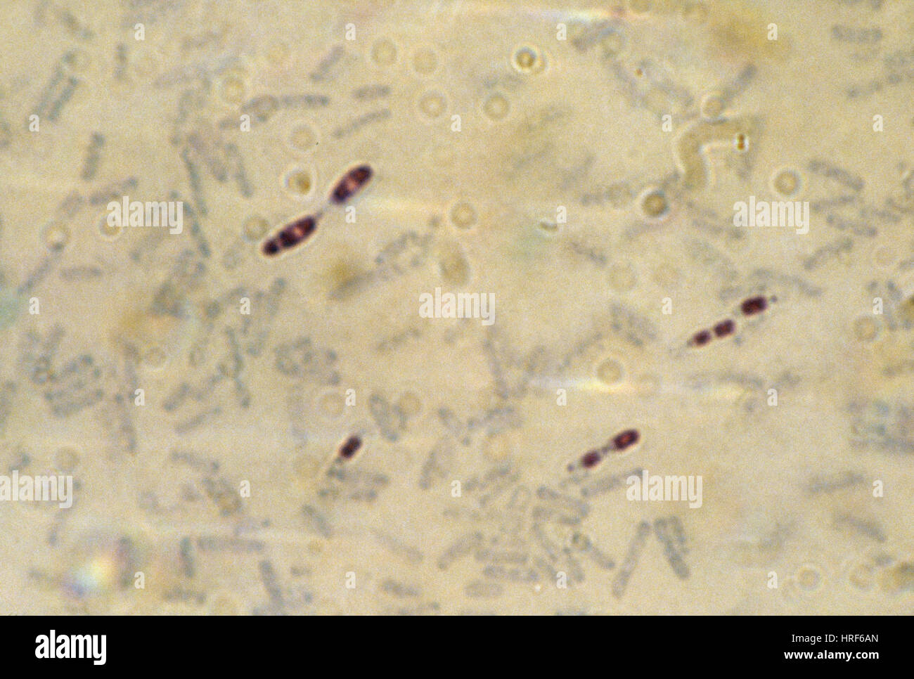 Spore dei batteri immagini e fotografie stock ad alta risoluzione - Alamy