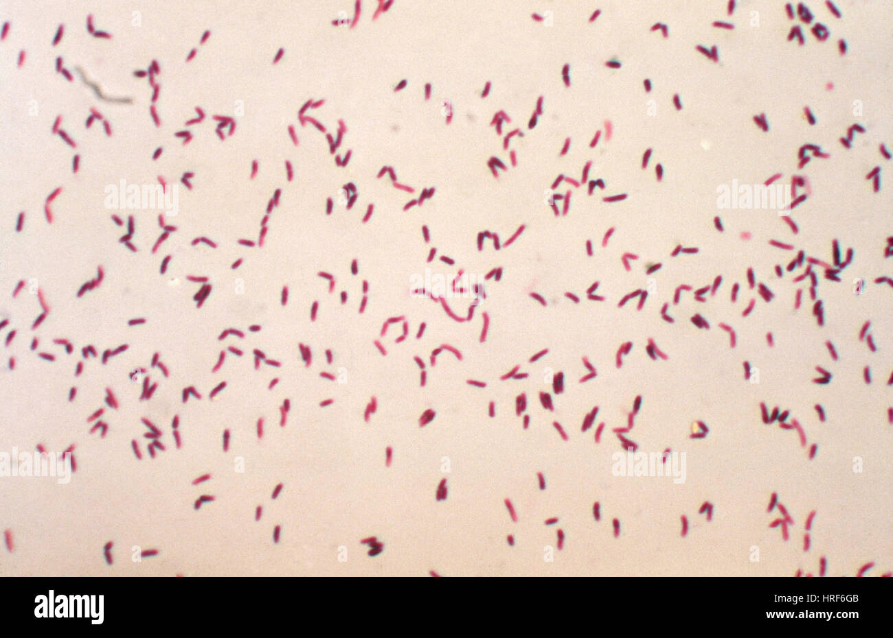 Corynebacterium diphtheriae bacteria immagini e fotografie stock ad ...