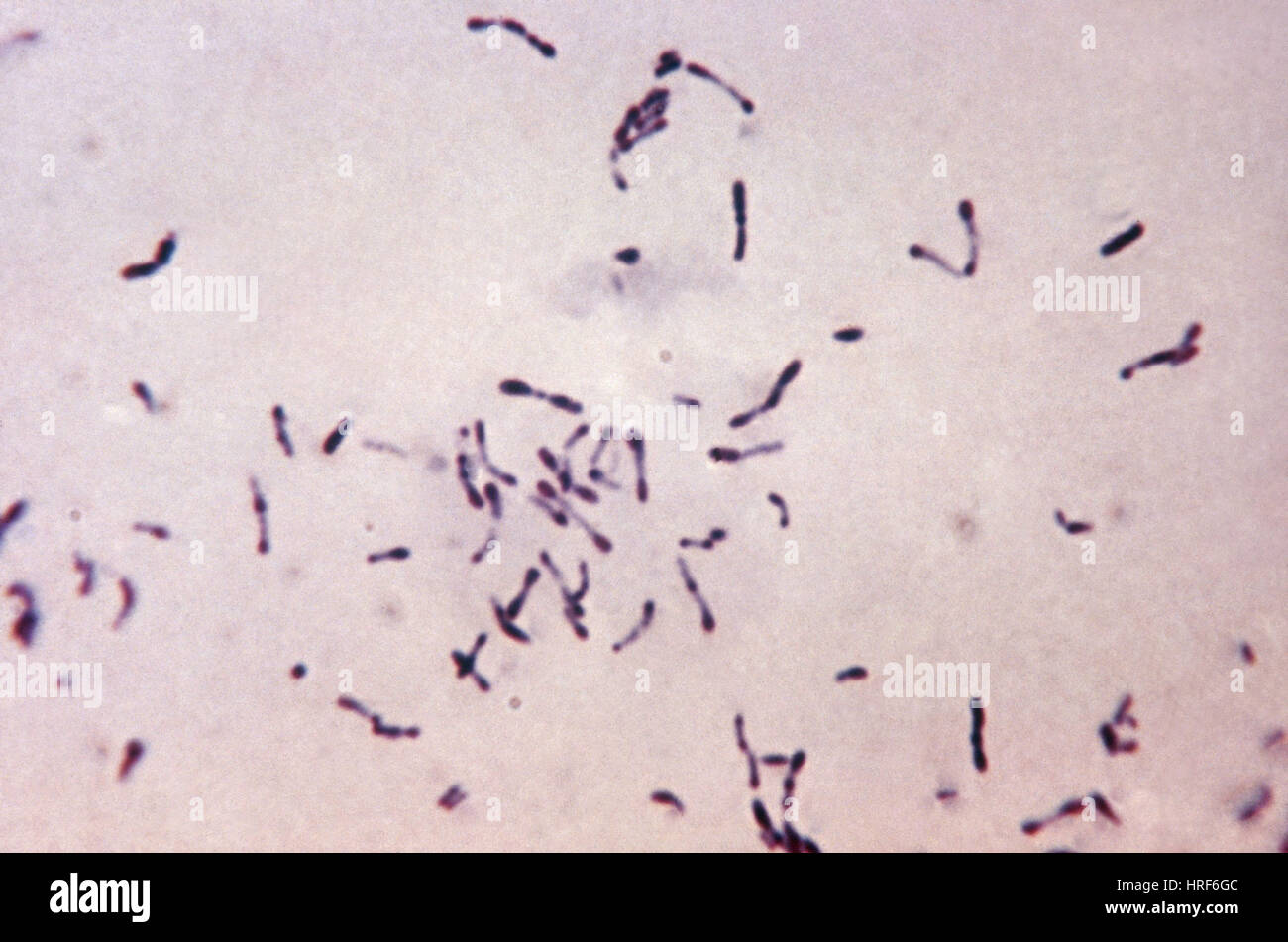Corynebacterium diphtheriae bacteria immagini e fotografie stock ad ...