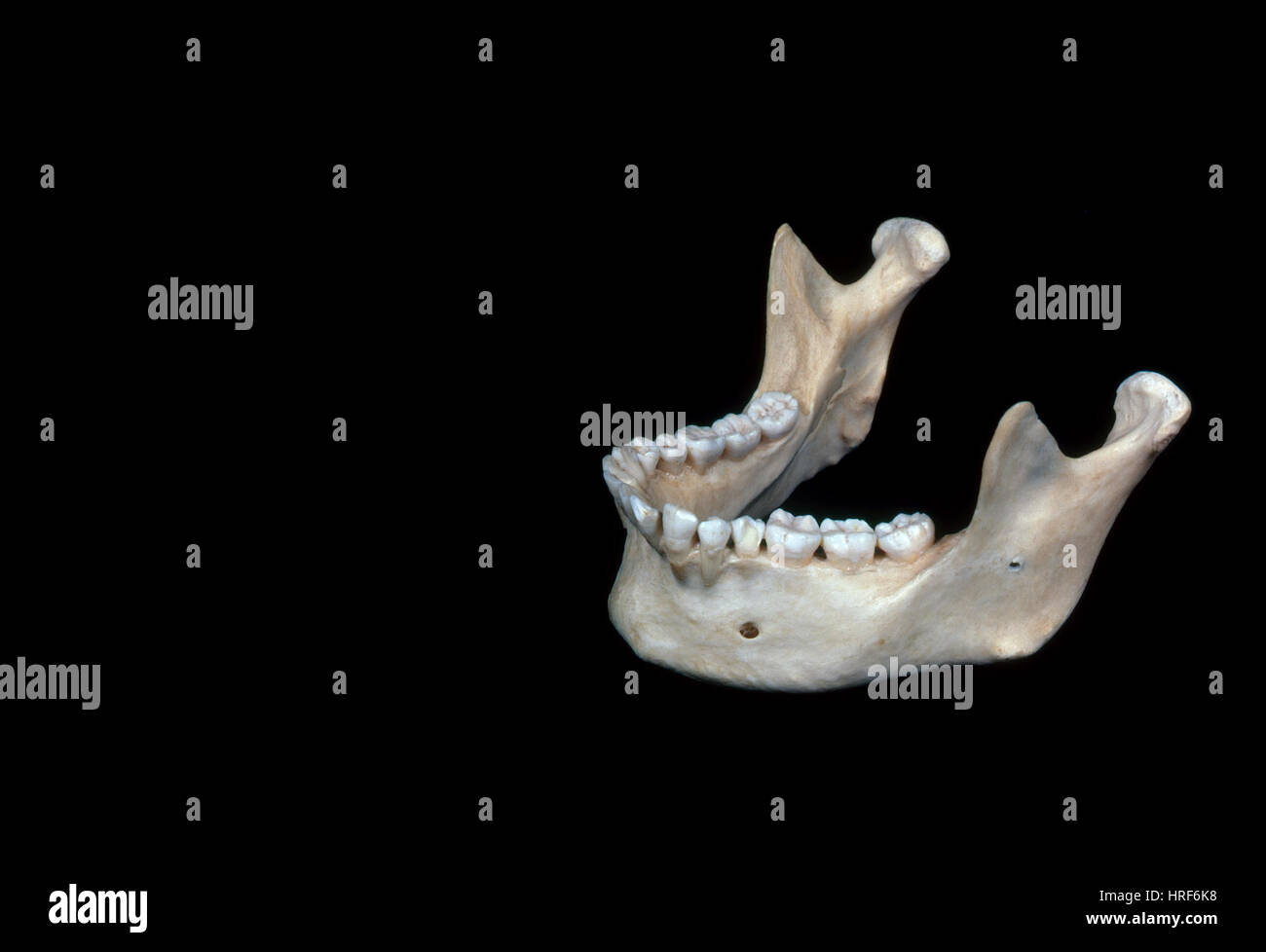 Mandibola mascella immagini e fotografie stock ad alta risoluzione - Alamy