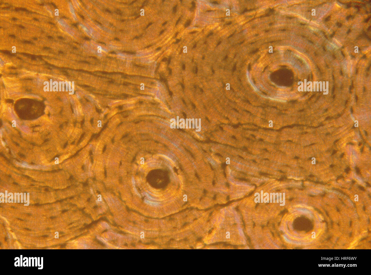 Cellule ossee immagini e fotografie stock ad alta risoluzione - Alamy