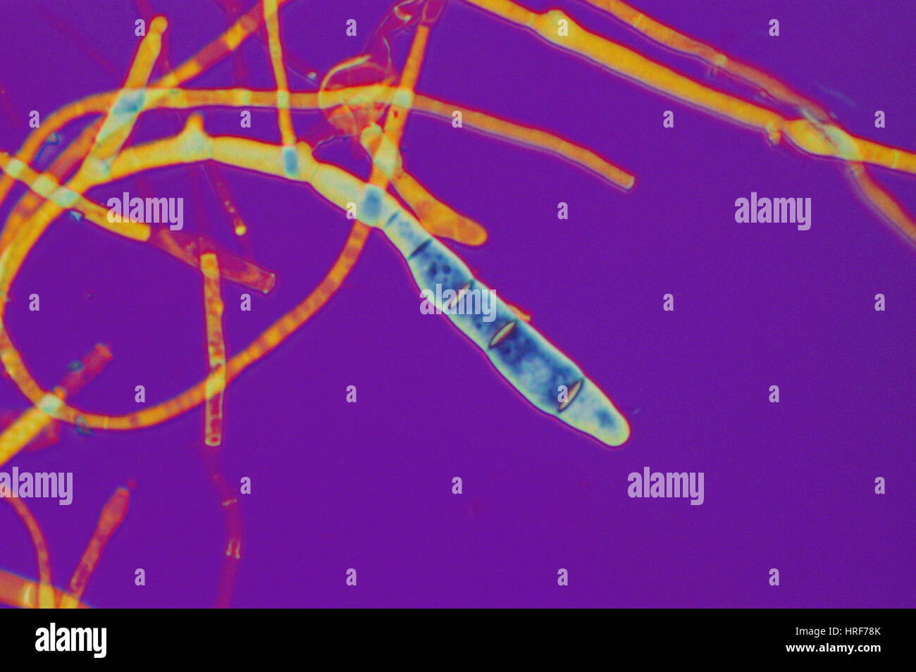 Epidermophyton floccosum immagini e fotografie stock ad alta ...