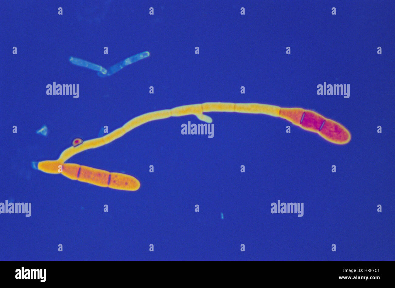 Epidermophyton floccosum immagini e fotografie stock ad alta ...