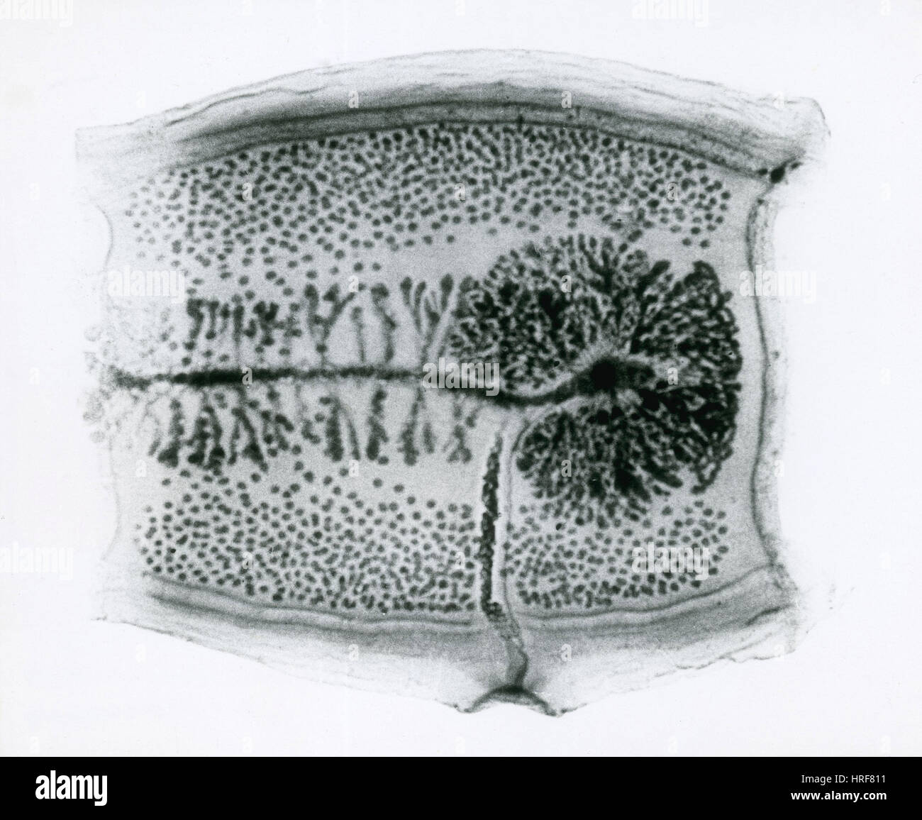 Taenia tapeworm immagini e fotografie stock ad alta risoluzione - Alamy