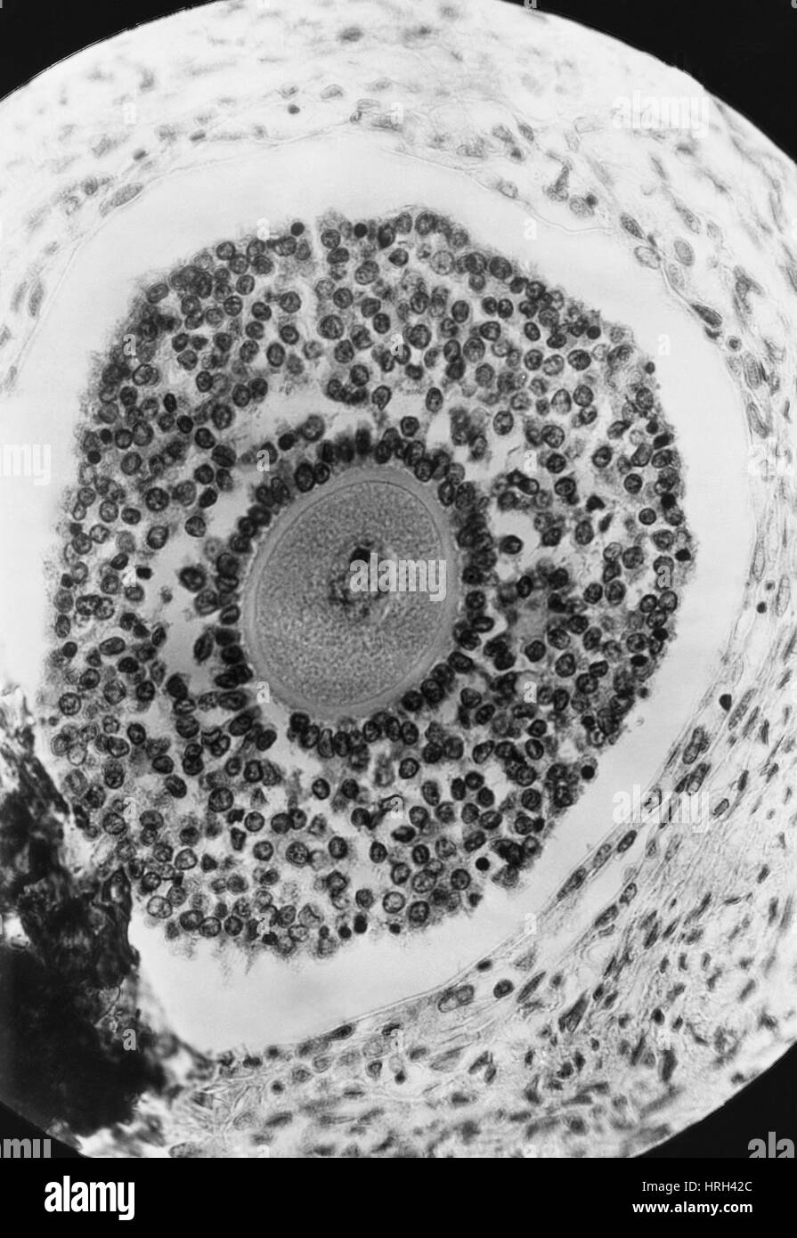 Histology human reproductive system immagini e fotografie stock ad alta ...