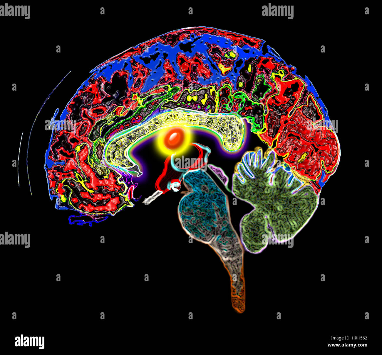 Cisti colloide immagini e fotografie stock ad alta risoluzione - Alamy