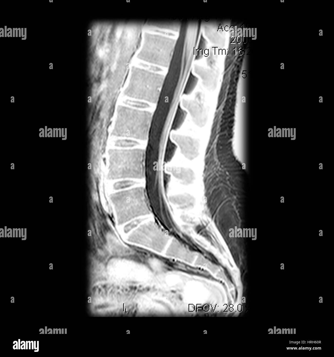Signor della colonna lombare immagini e fotografie stock ad alta ...