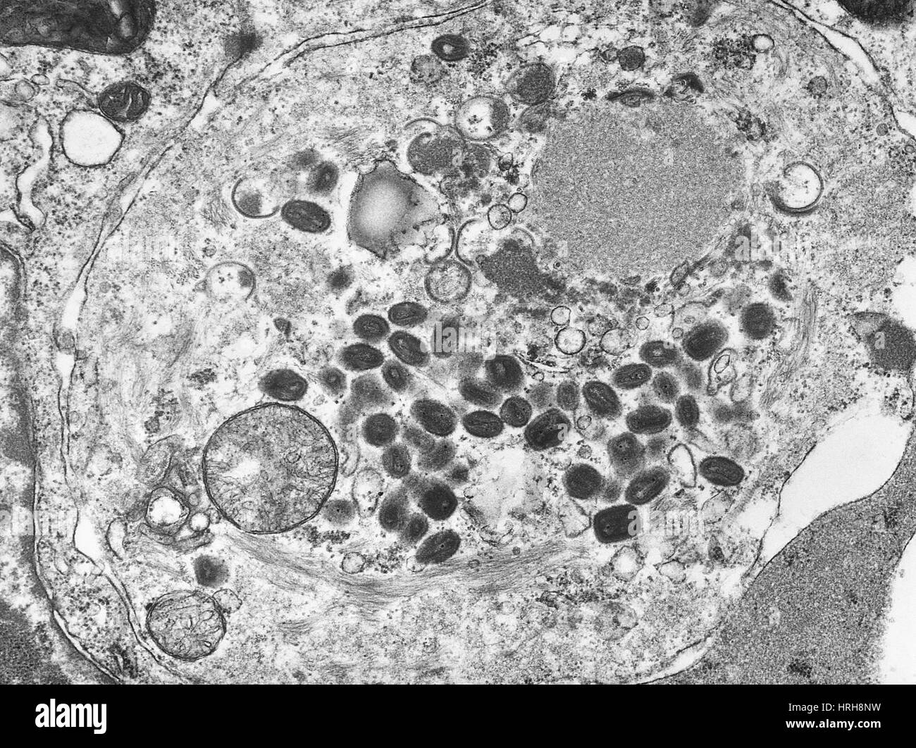 Virus del vaiolo immagini e fotografie stock ad alta risoluzione - Alamy