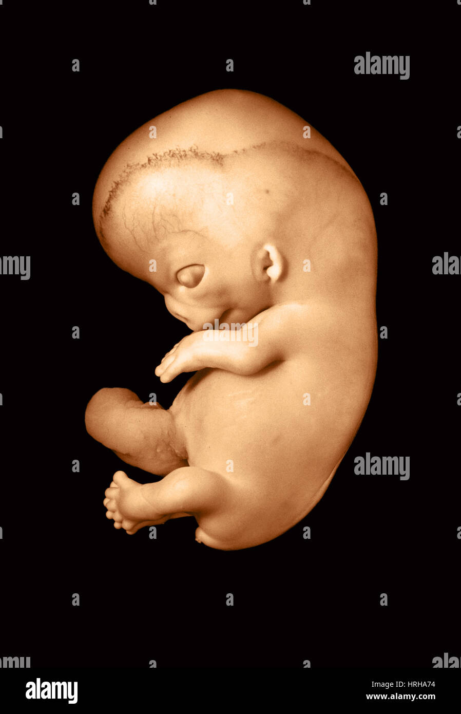 Periodo fetale immagini e fotografie stock ad alta risoluzione - Alamy