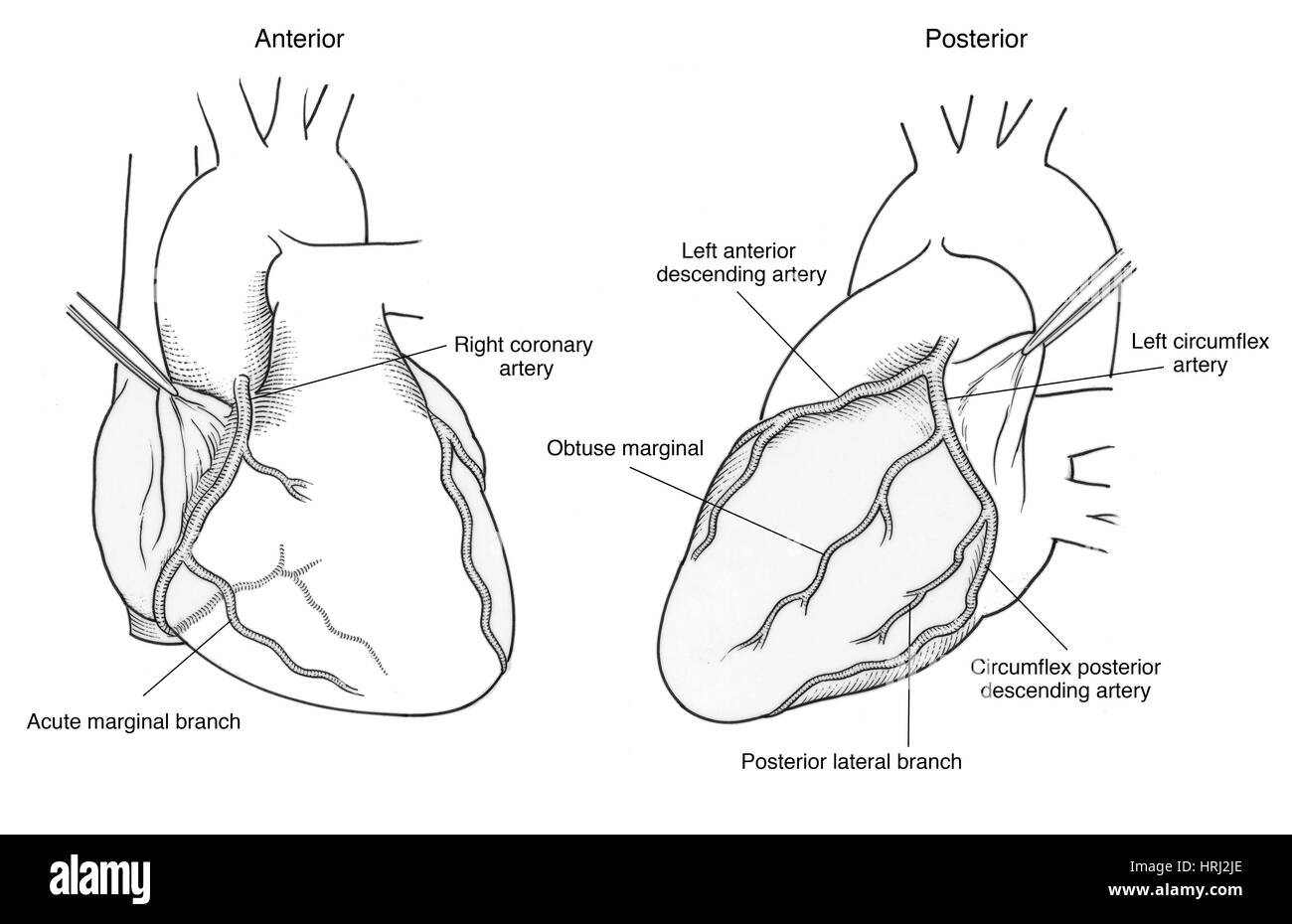 Illustrazione di arterie coronarie Foto stock - Alamy