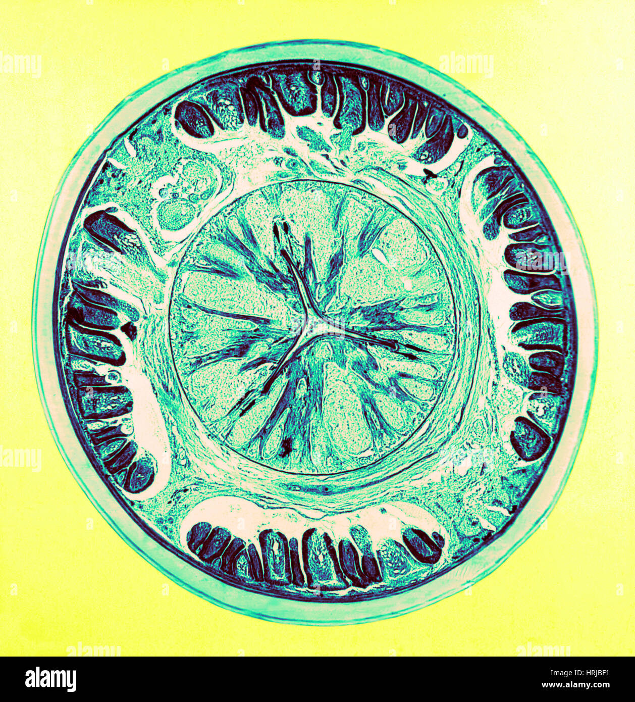 Sezione trasversale ascaris immagini e fotografie stock ad alta ...