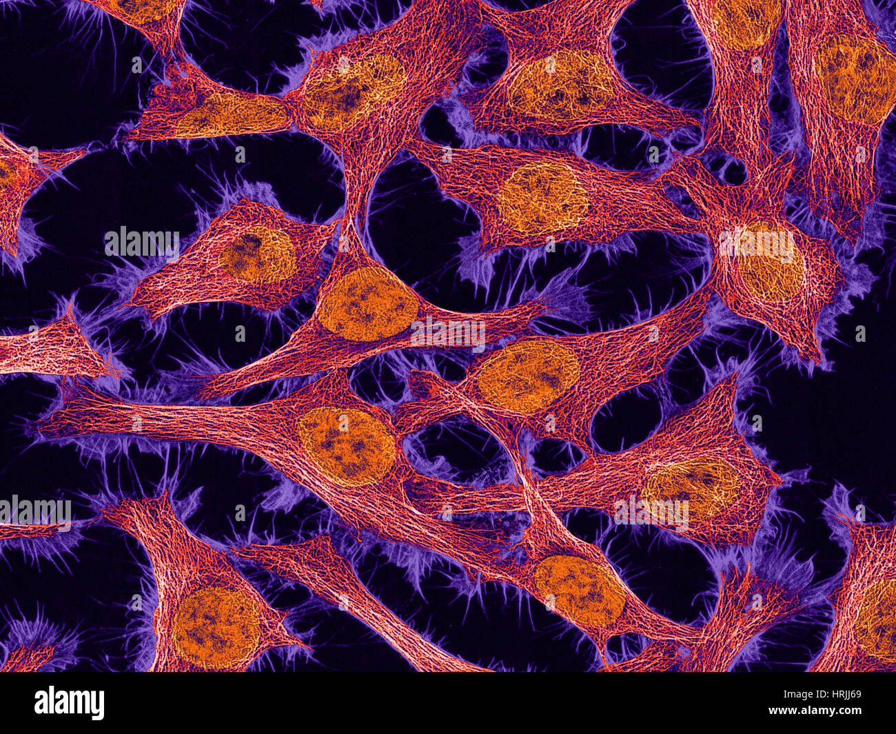 Hela cells immagini e fotografie stock ad alta risoluzione - Alamy