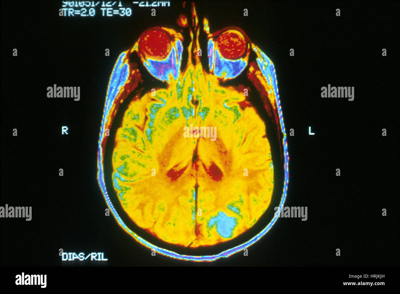 Imaging mri nmr immagini e fotografie stock ad alta risoluzione - Alamy