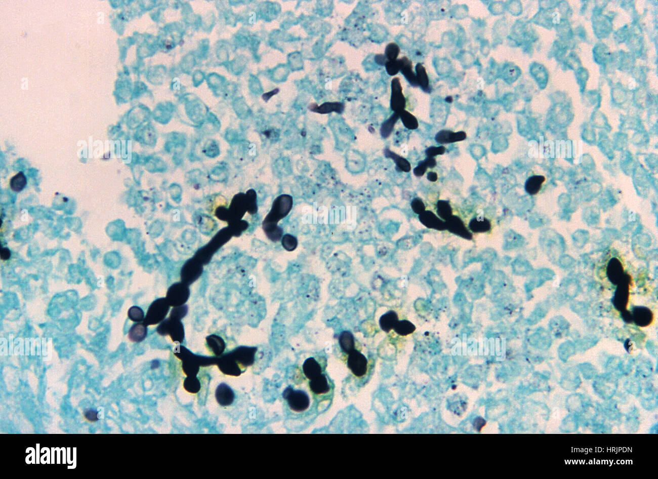 Fungo candida albicans immagini e fotografie stock ad alta risoluzione ...