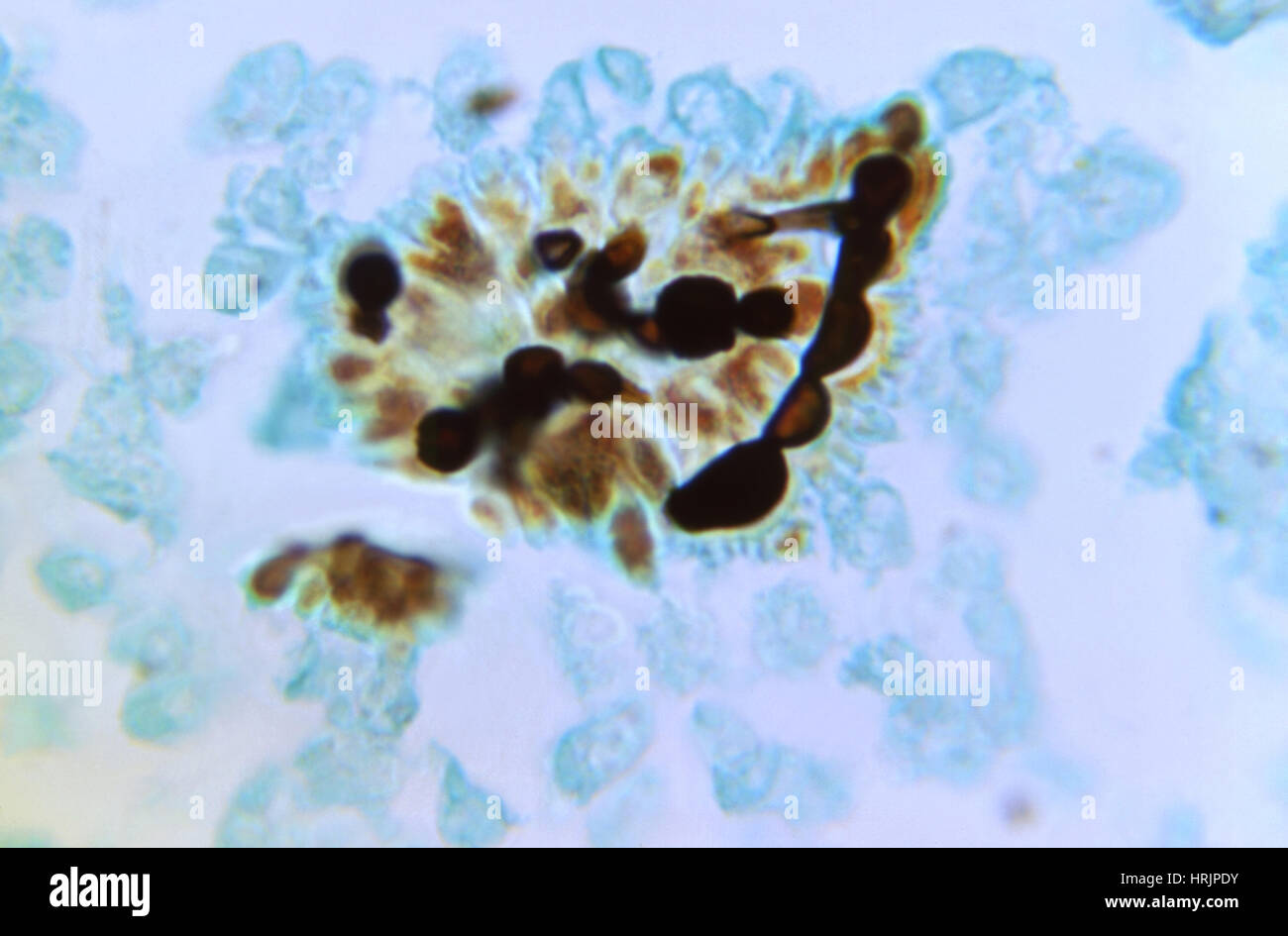 Candida Albicans Fungi Immagini e Fotos Stock - Alamy