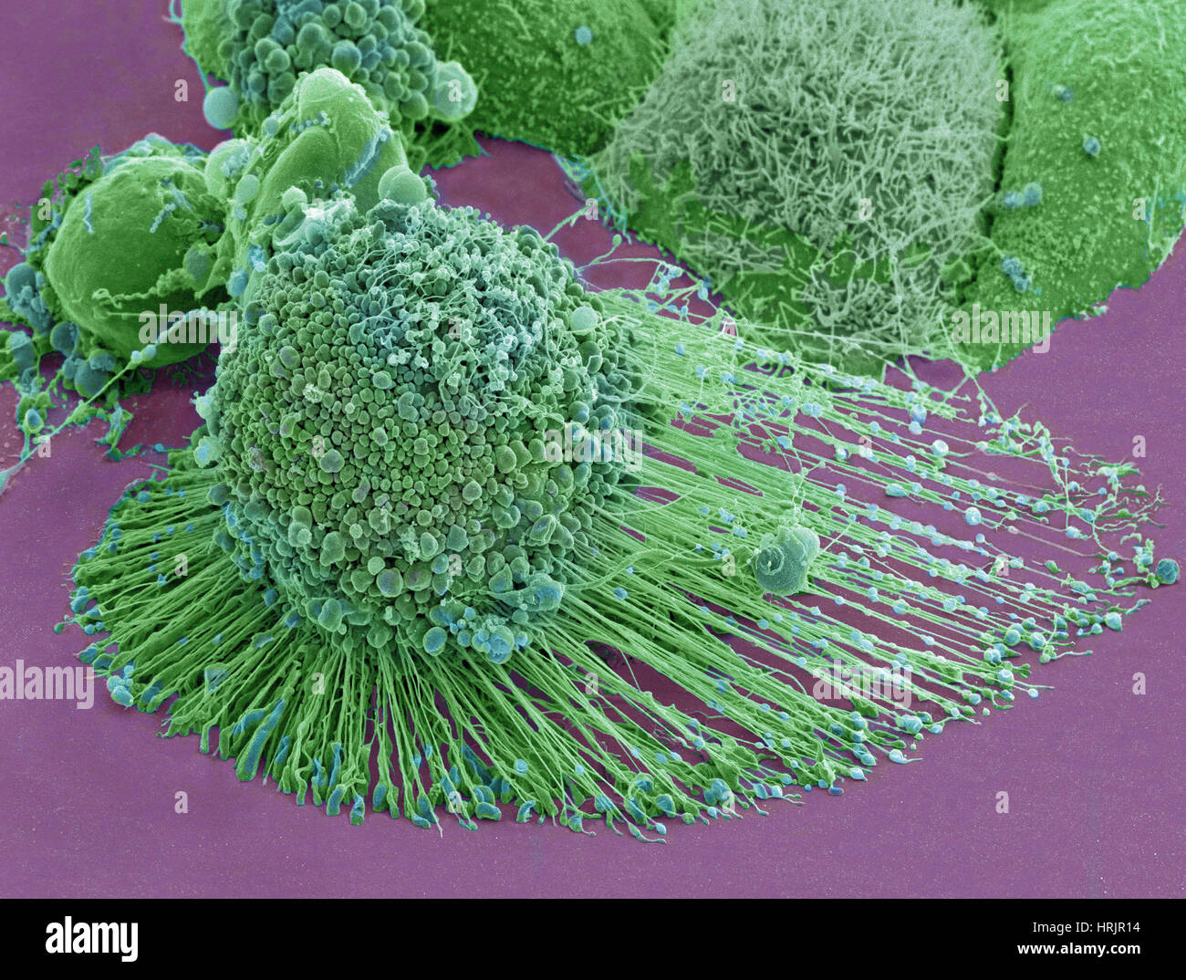 Morte delle cellule cancerogene sem immagini e fotografie stock ad alta ...