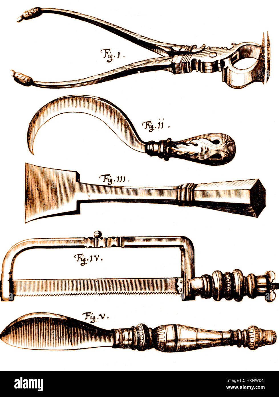 18th century surgical instruments immagini e fotografie stock ad alta ...