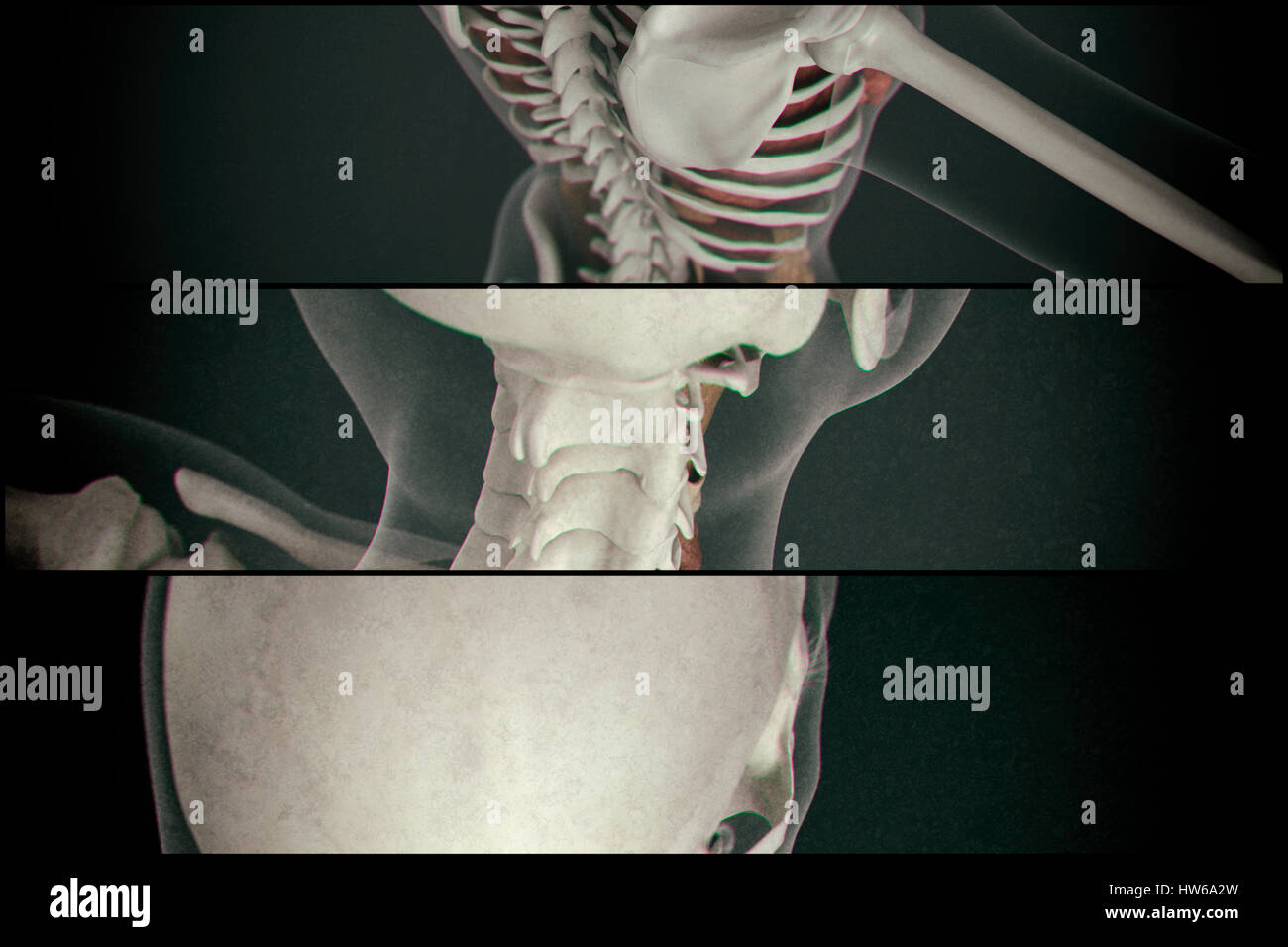 Cranio umano sezione immagini e fotografie stock ad alta risoluzione ...