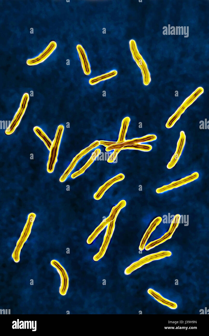 Mycobacterium tuberculosis gram positive immagini e fotografie stock ad ...