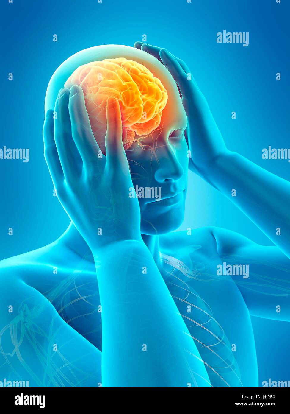 Anatomia di persona con cefalea, illustrazione Foto stock - Alamy