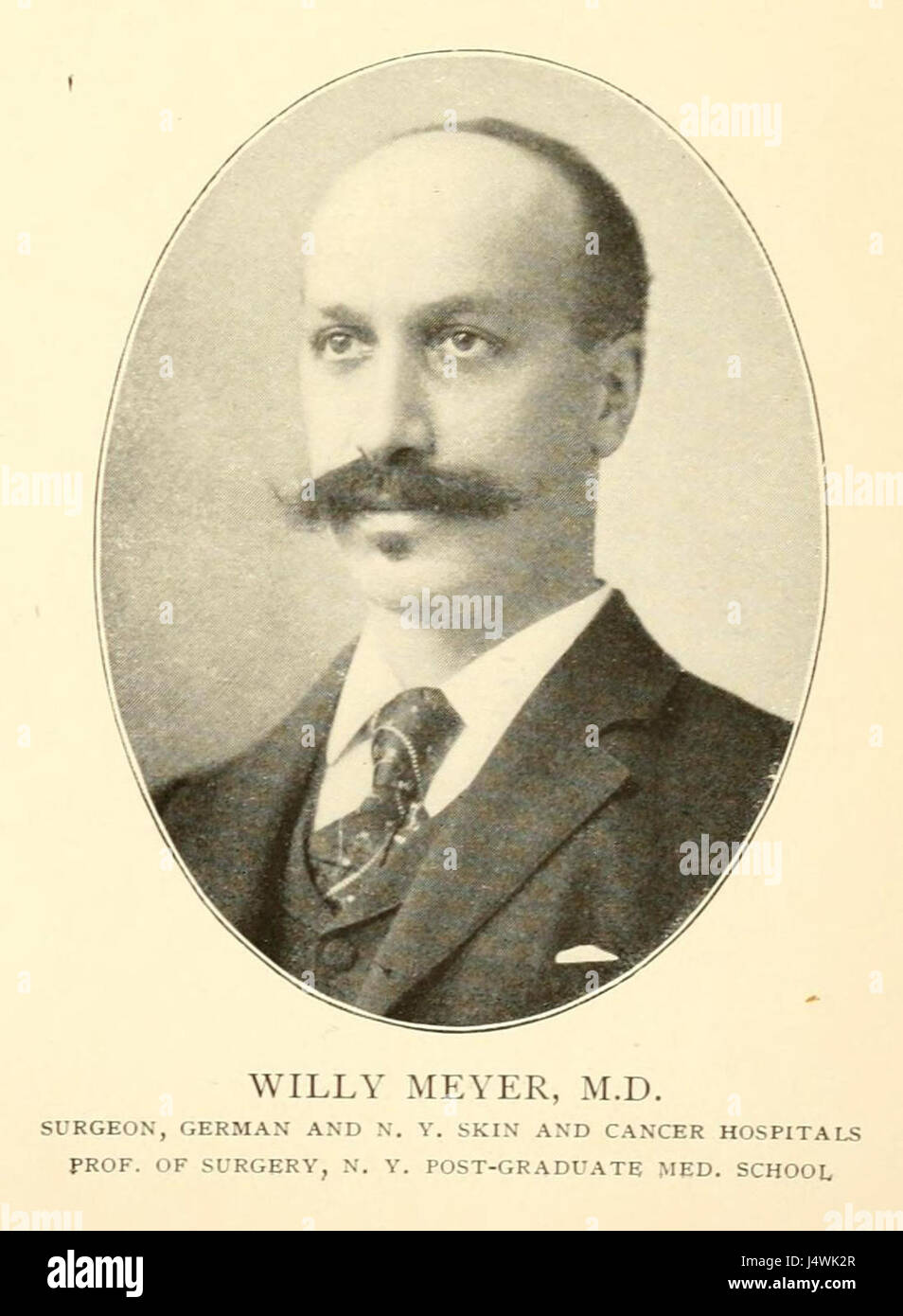 Willy meyer immagini e fotografie stock ad alta risoluzione - Alamy