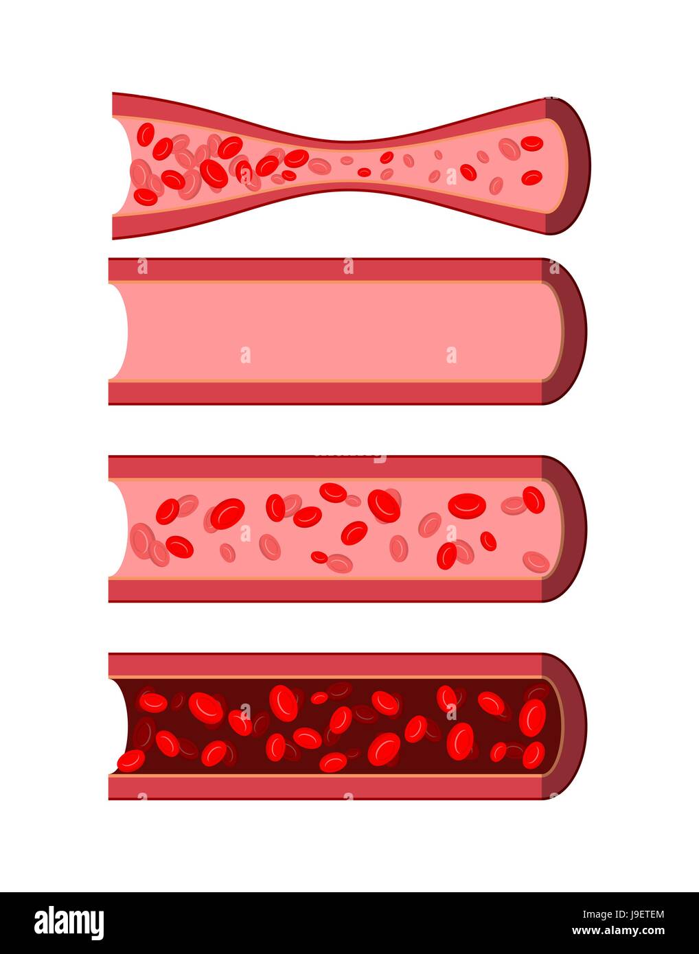 Sangue malato Immagini Vettoriali Stock - Alamy