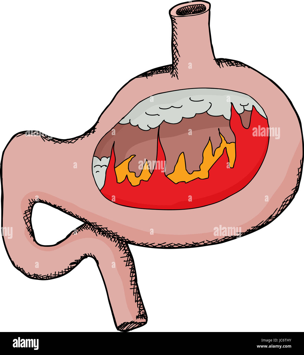 Simbolo del reflusso acido indigestione con fiamme di stomaco Foto ...