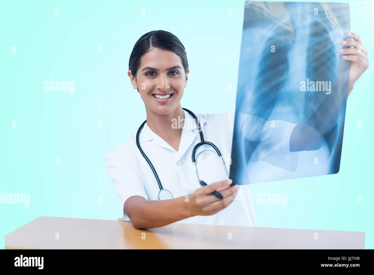 Radiografia toracica immagini e fotografie stock ad alta risoluzione ...