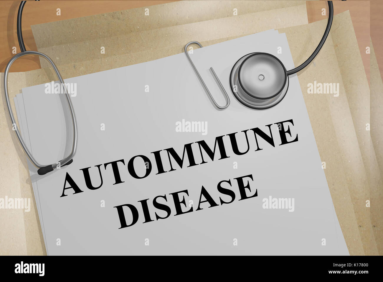 Malattia autoimmune immagini e fotografie stock ad alta risoluzione - Alamy