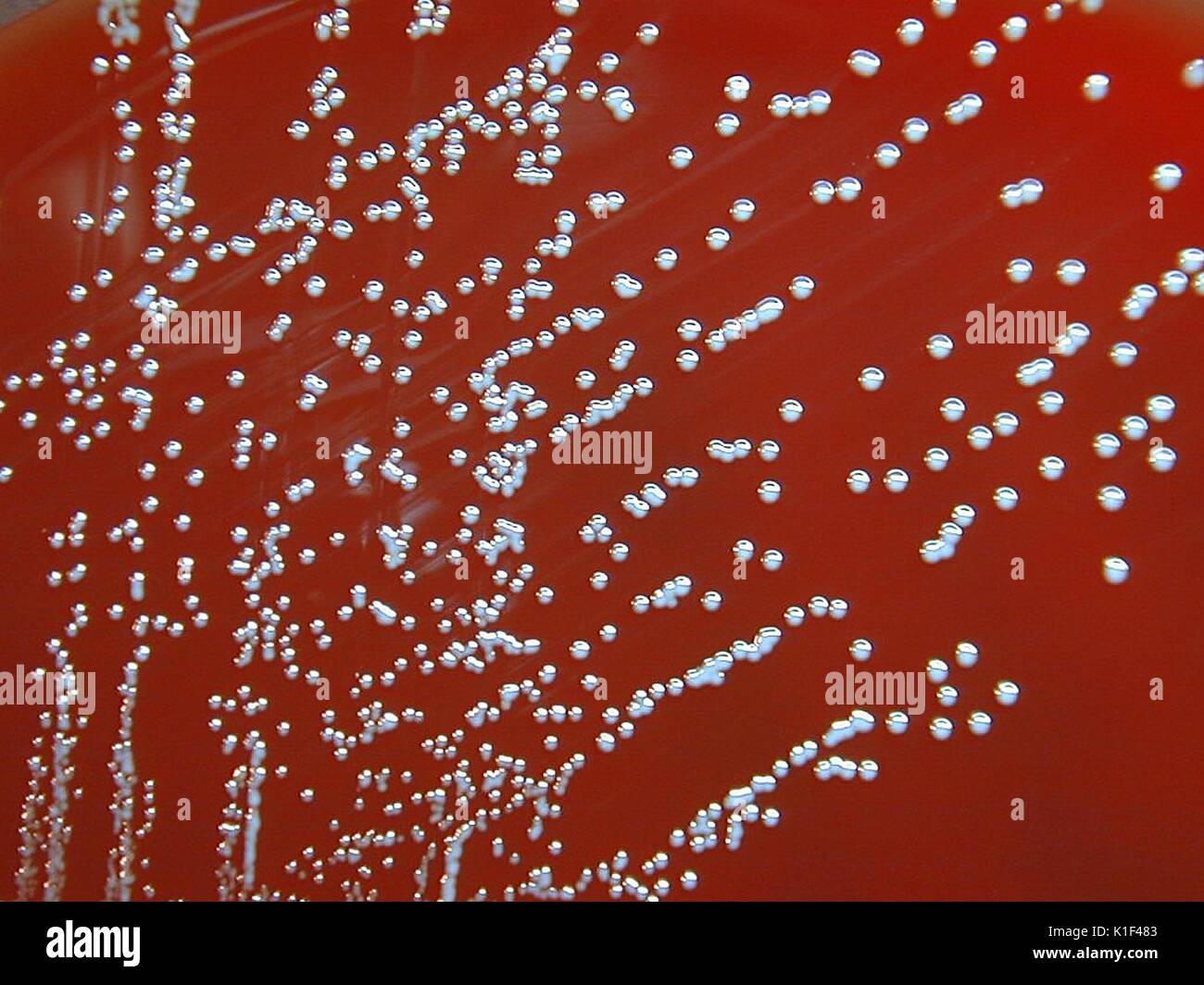 Brucella melitensis immagini e fotografie stock ad alta risoluzione - Alamy