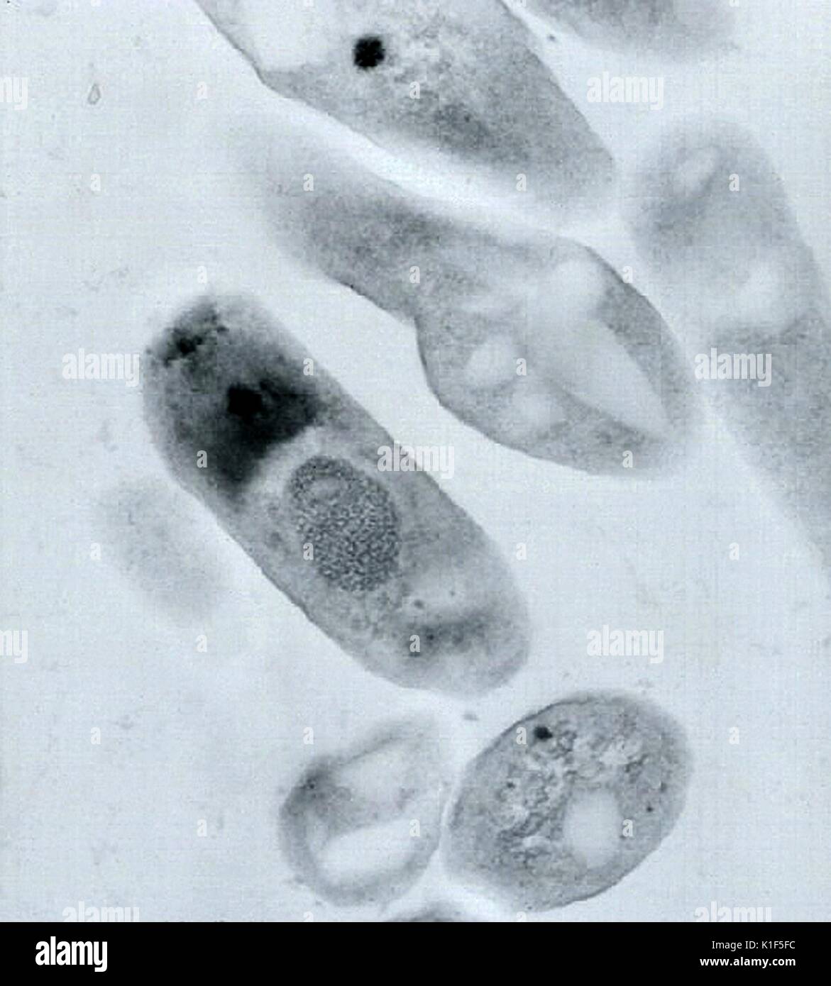 Bacillus anthracis immagini e fotografie stock ad alta risoluzione - Alamy