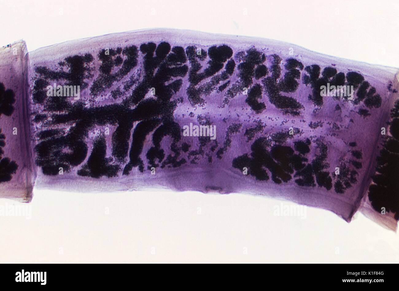 Proglottidi taenia solium immagini e fotografie stock ad alta ...