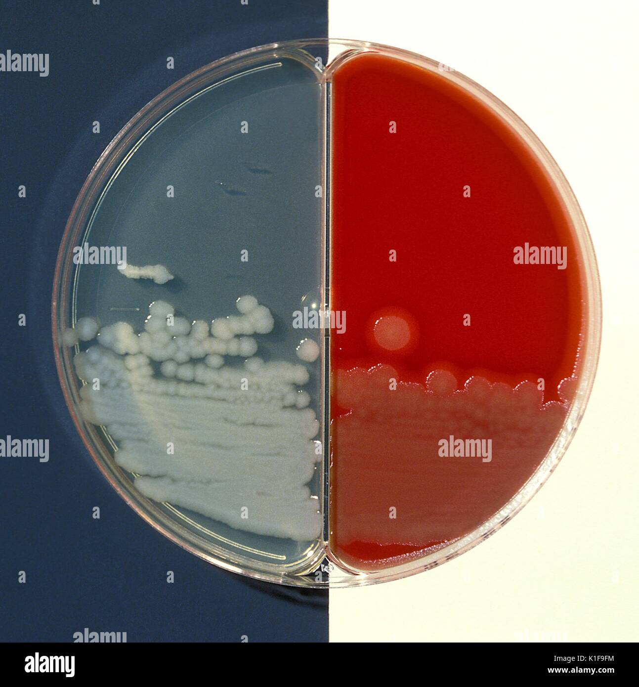 Agar di Sangue e bicarbonato piastra di agar di colture di Bacillus ...