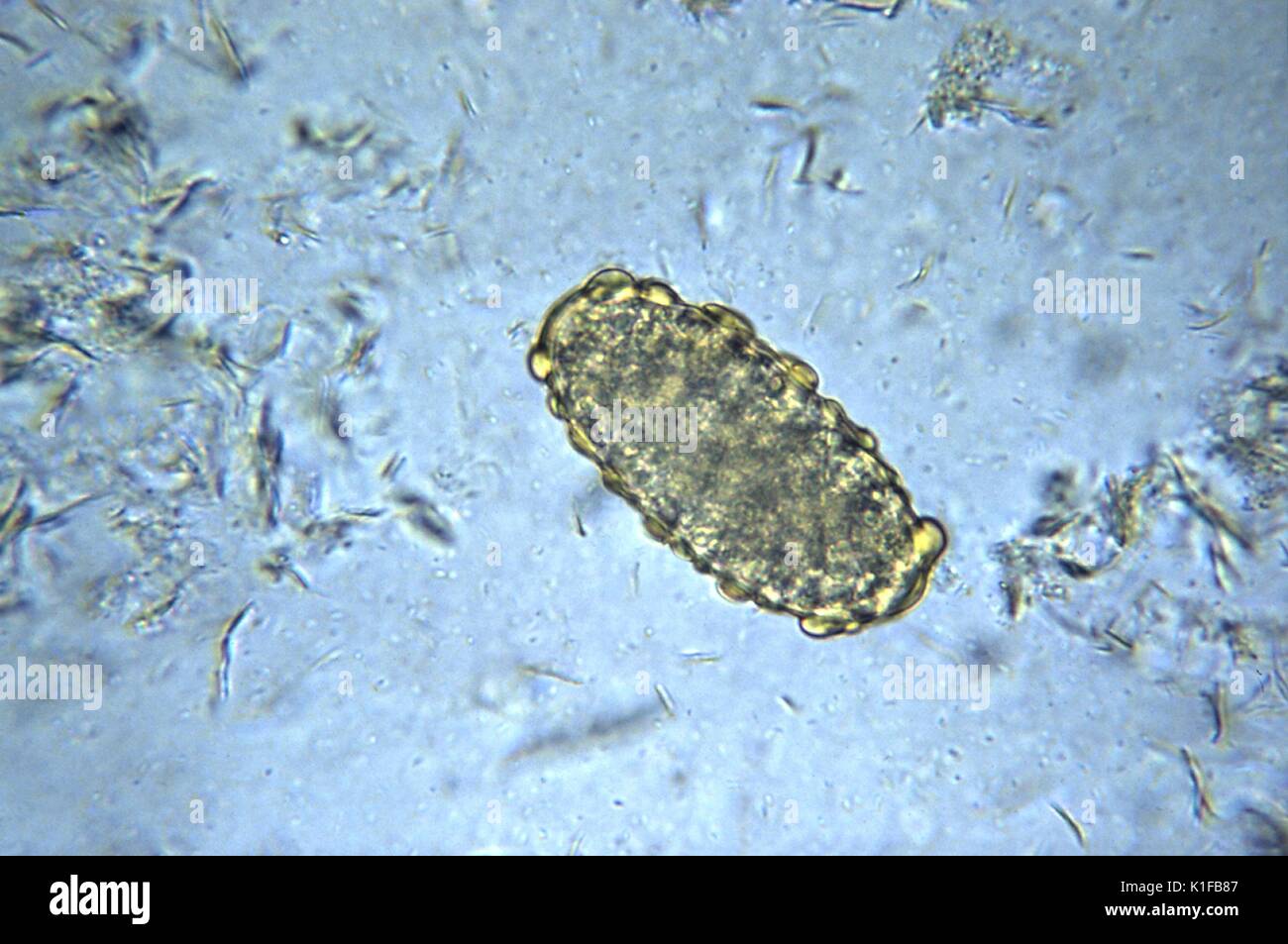 Ascaris lumbricoides immagini e fotografie stock ad alta risoluzione ...