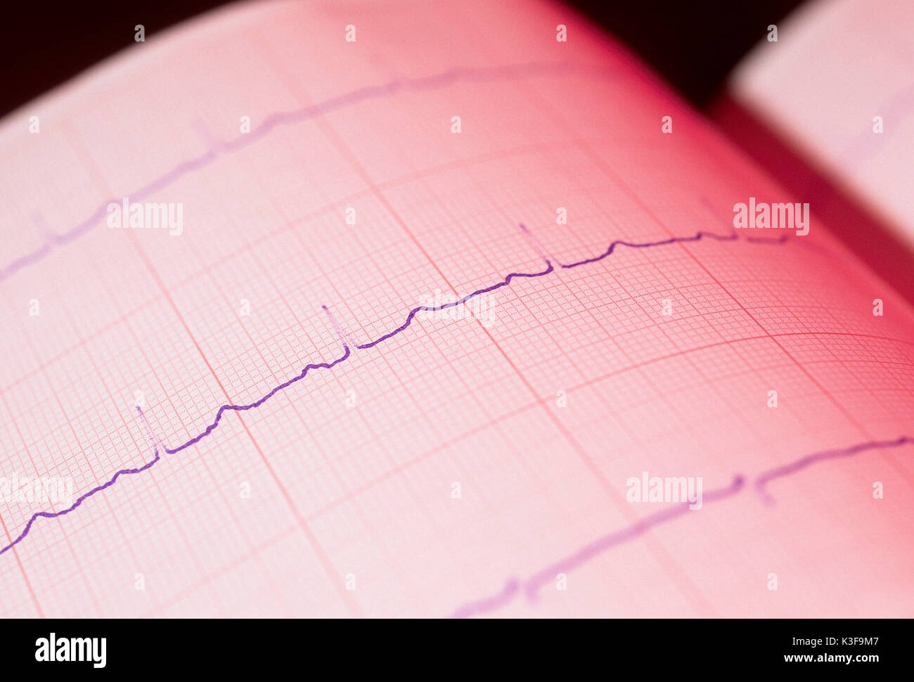 Stampa ecg immagini e fotografie stock ad alta risoluzione - Alamy