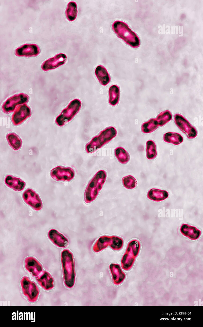 Yersinia pestis bacteria immagini e fotografie stock ad alta ...