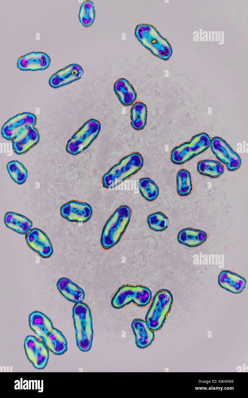 Yersinia pestis plague immagini e fotografie stock ad alta risoluzione ...