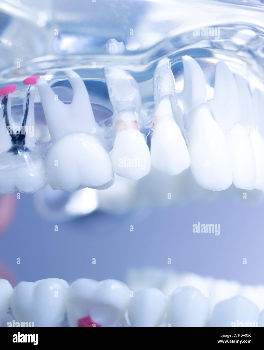 Denti dentale bocca dentisti modello didattico con i denti e le gengive ...