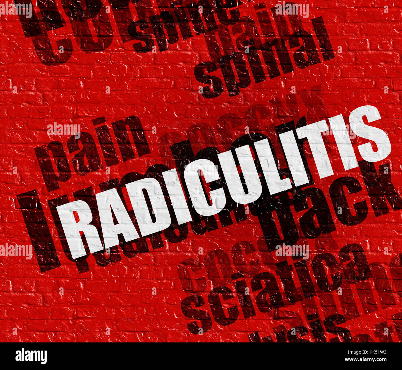 Nervio radicular immagini e fotografie stock ad alta risoluzione - Alamy