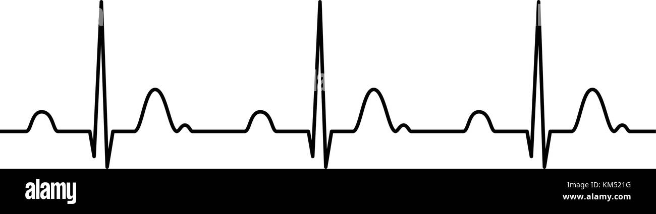 Ecg normale (elettrocardiogramma) , ritmo cardiaco ecg , isolato nero ...