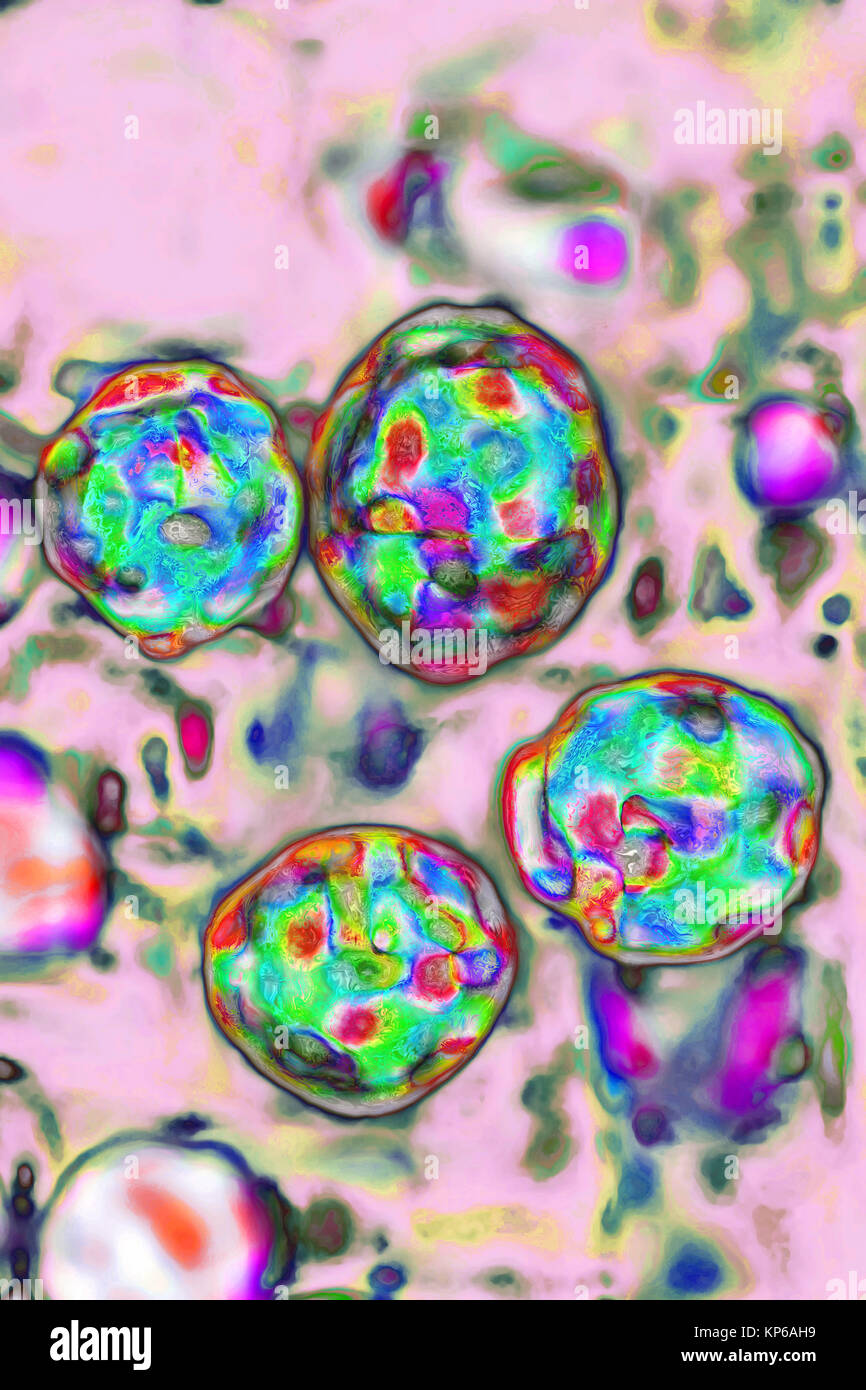 Paramyxovirus paramyxoviridae immagini e fotografie stock ad alta ...