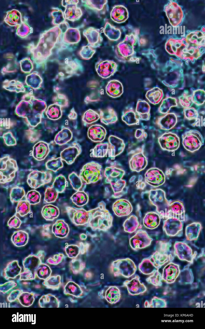 Paramyxovirus paramyxoviridae immagini e fotografie stock ad alta ...