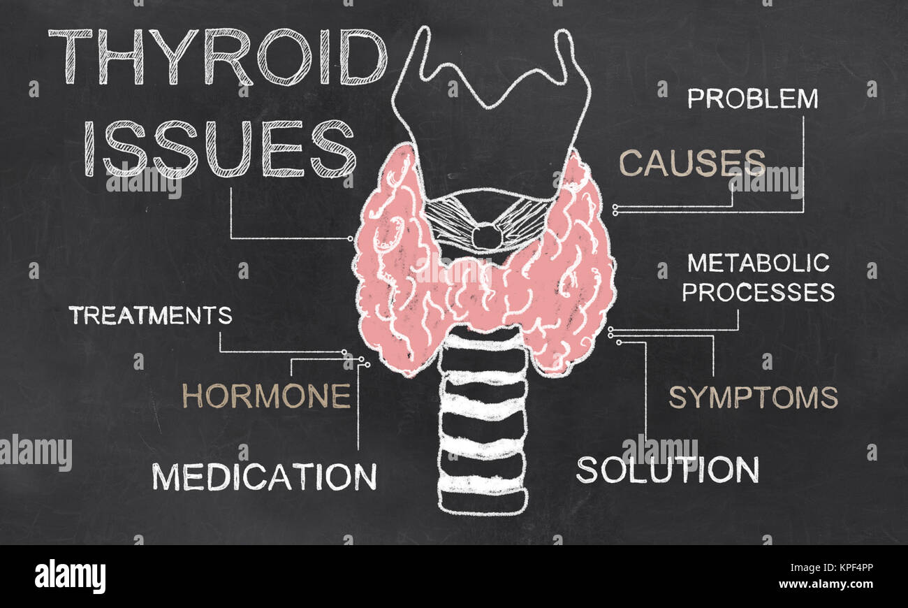 Problema alla tiroide immagini e fotografie stock ad alta risoluzione ...