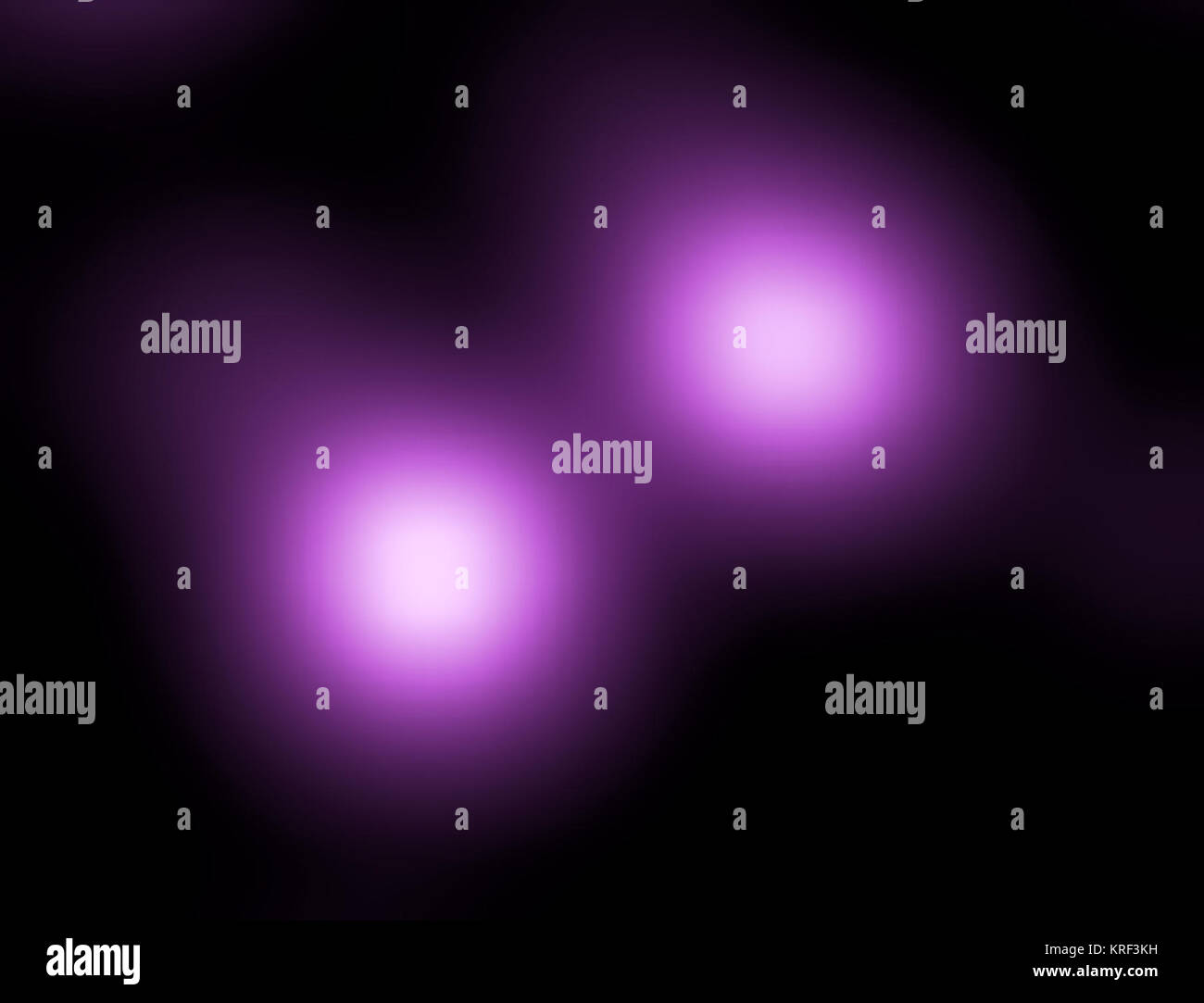 Radiografia chandra immagini e fotografie stock ad alta risoluzione - Alamy